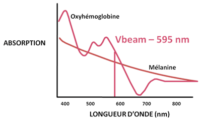 Laser vasculaire - Centre Laser Strasbourg-Rhin
